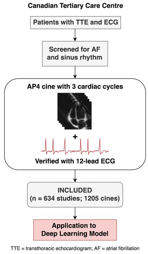 Automated Atrial Fibrillation Diagnosis By Echocardiography Without Ecg
