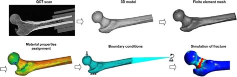 Overview Of The Qct Fea Modeling The Qct Scan Was Segmented To Obtain Download Scientific