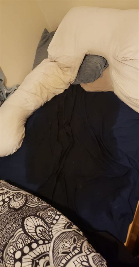 Does Anyone Remember This King R Hyperhidrosis