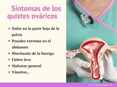 Isabel Rangel Barón Quistes en los ovarios Síntomas causas y tratamiento