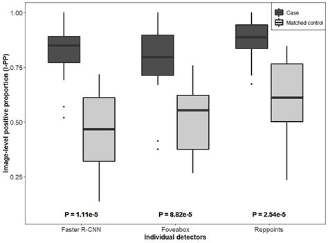 Preoperative Diagnosis Of Hepatocellular Carcinoma Patients With Bile