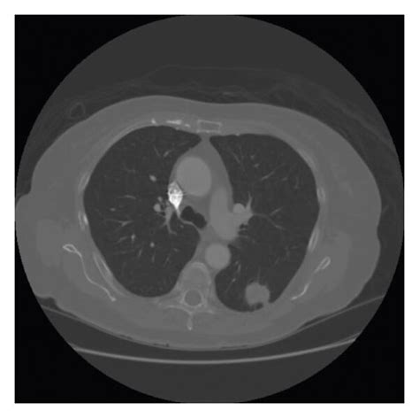 a original dicom image b processed dicom image download