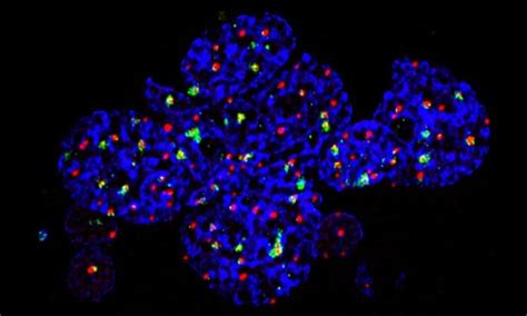 Old Human Cells Rejuvenated With Breakthrough Anti Aging Discovery
