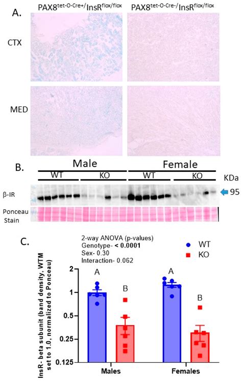 Sex Modulates Response To Renal Tubule Targeted Insulin Receptor