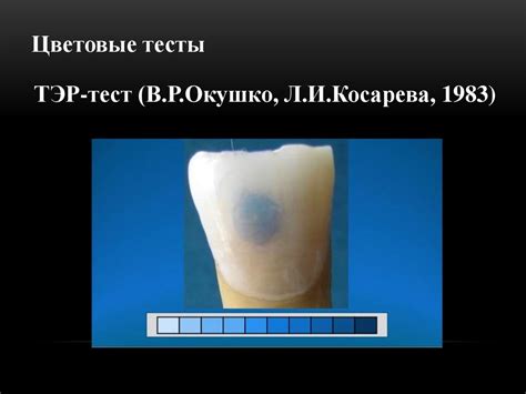 Методы обследования в детской стоматологии презентация онлайн