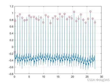 wfdb工具箱在matlab2010b及更高版本上的安装 matlab wfdb csdn博客