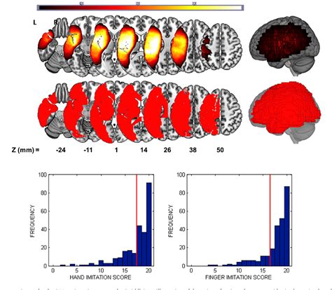figure 1 from using multi level bayesian lesion symptom mapping to