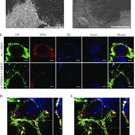 Filamentous Structures Contain Ebola Virus Ebov Structural Proteins