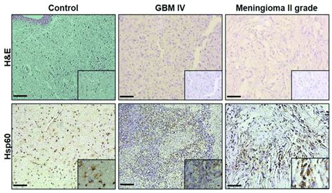 Illustrative Examples Of The Histological And Immunohistochemical Download Scientific Diagram
