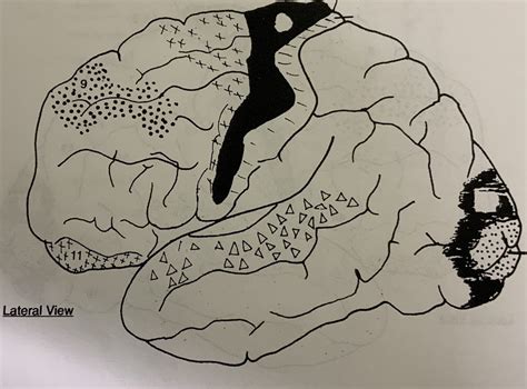 Brodmann Areas Lateral View Diagram Quizlet