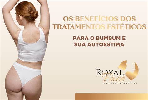 Tratamentos Estéticos Benefícios Para O Bumbum E Autoestima