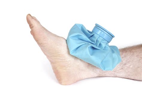 Common Foot And Ankle Injuries Foot Surgeon Fairfield Ct