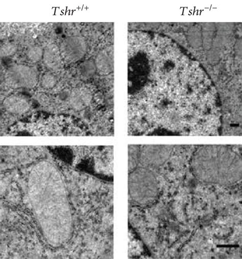 Hepatic Mitochondrial Stress In Tshr And Tshr Mice Tshr Mice