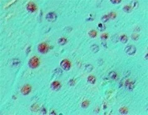 Neurogenin 3 Antibody Bsa Free Novus Biologicals 0025mg Unlabeled