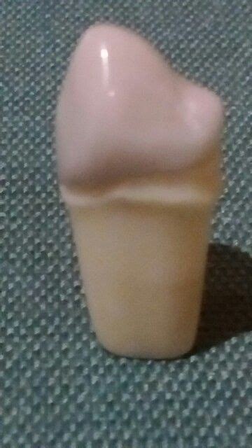 Interproximal Part Of The Crown Of Tooth 23