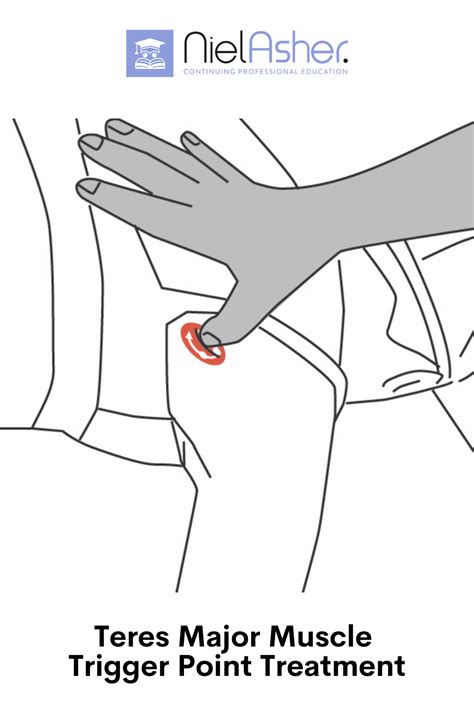 Occipitofrontalis Muscle Trigger Point Treatment Artofit