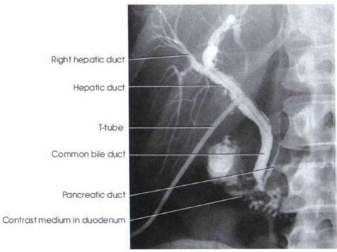 Investigation Of Biliary Tract