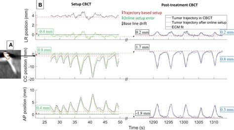 Example Of A Reconstructed Cbct And B Tumor Motion During Cbct Download Scientific Diagram