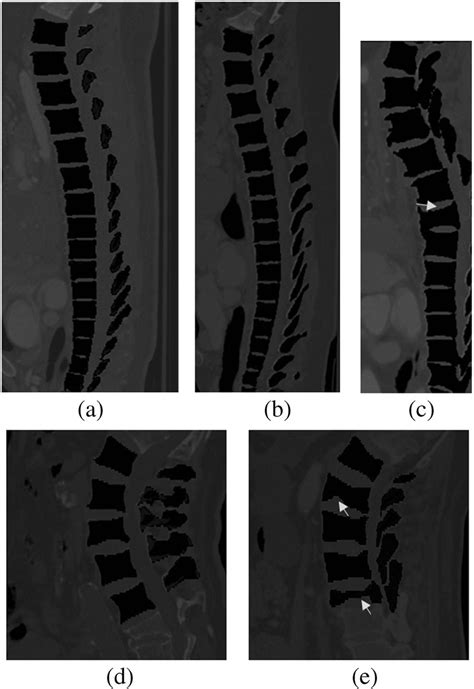 Segmentation Results Of Our Proposed System A B Results Of Csi