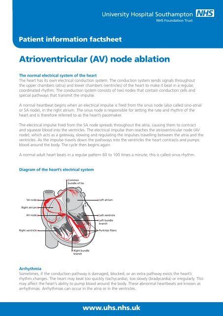 Atrioventricular Av Node Ablation