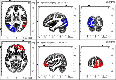 Visual Perception Network The Visual Perception Network Is Composed Of