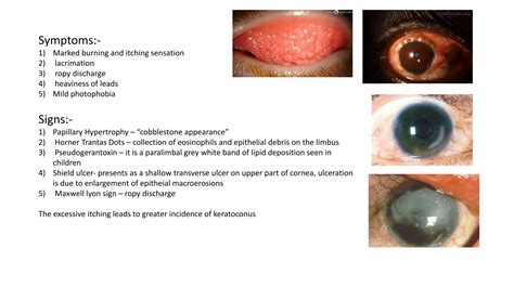Conjunctiva Pptx