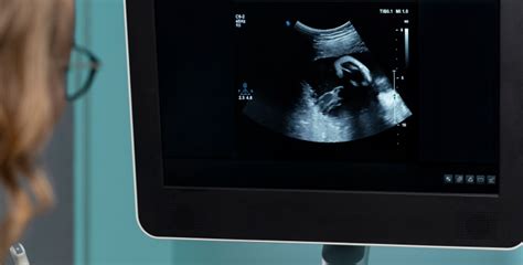 Scans Retained Product Of Conception Rpoc Rainbow Hospital