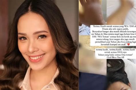 Lady Nayoan Bagikan Kondisi Paska Kecelakaan Tangan Dan Kaki Penuh