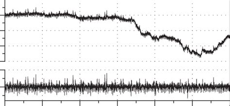 Removal Of Baseline Wander From The Ecg Using Digital Frequency Filters Download Scientific