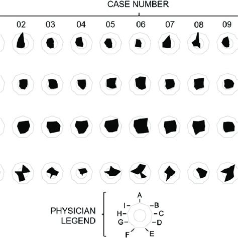Radar Plots Showing The Values Of Features From The Numeric