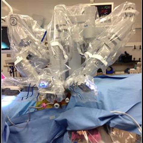 Pdf Minimally Invasive And Robotic Esophagectomy A Review
