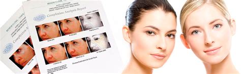 Visia Complexion Analysis Dr Sujata Garach