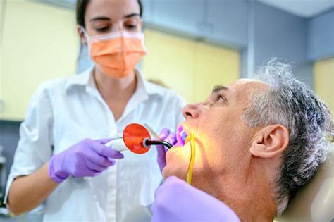 환자의 치아를 치료하는 동안 Uv 램프를 사용하는 치과 의사 자외선에 대한 스톡 사진 및 기타 이미지 자외선 전등 레이저