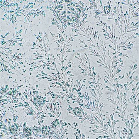 The Beauty Of Fertility Ferning