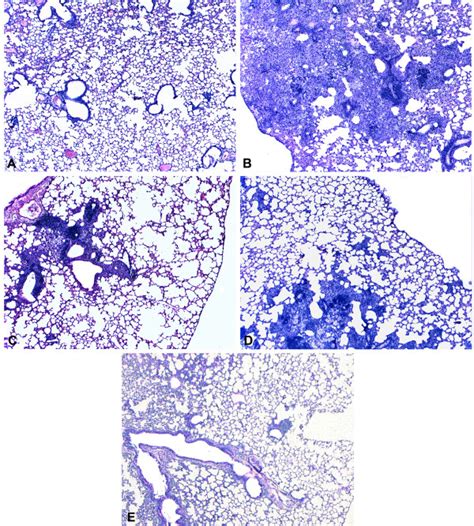 Comparison Of Lung Parenchyma From Mice Immunized With COMP Hsp65 Or