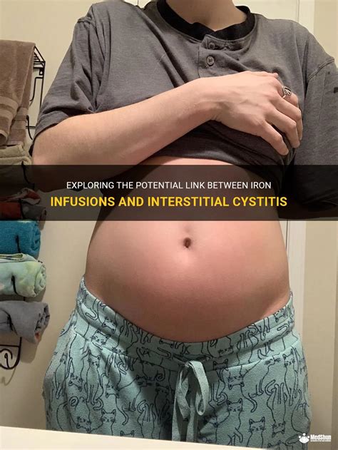 Exploring The Potential Link Between Iron Infusions And Interstitial