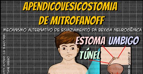 Apendicovesicostomia De Mitrofanoff Enfermagem Ilustrada
