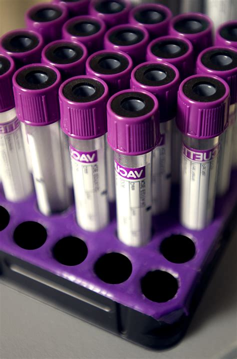 Kostenlose Bild: lila, überstiegen, Vacutainer, Blut, Sammlung, Rohre ...