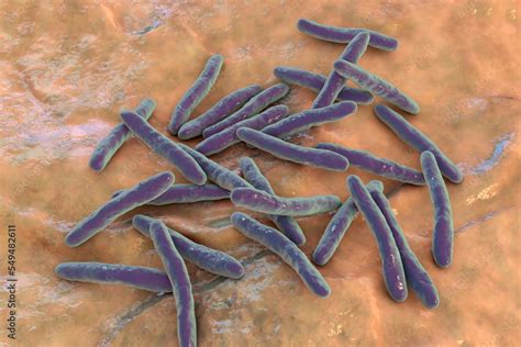 Bacteria Mycobacterium Tuberculosis The Causative Agent Of Tuberculosis Stock Illustration