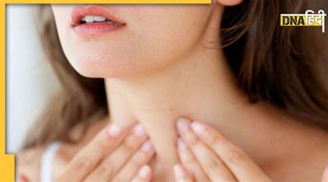 Thyroid Diet Plan बढ़ते थॉयराइड के लिए खाने में फॉलो करें ये सिंपल