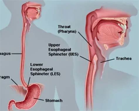 Heart Burn ————————————————————————————————— Question What Style Of Trigger Point Therapy Or