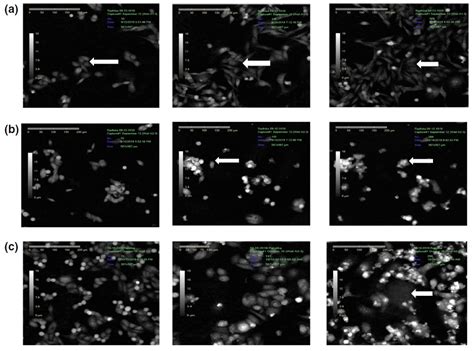 Holomonitor Quantitative Live Cell Imaging In Drug Discovery Phi