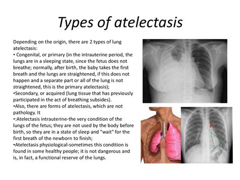 Tachycardia Online Presentation