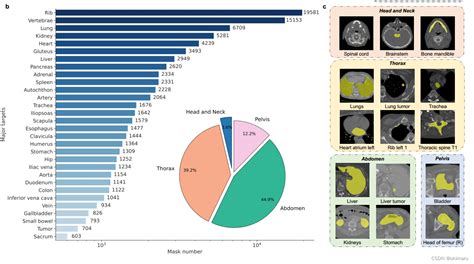 segvol universal and interactive volumetric medical image segmentation