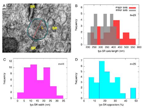 A High Magnification 150000× Electron Micrograph Of A Region Of Download Scientific Diagram