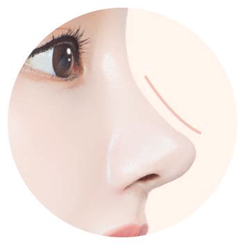Nose Tip Surgery ONYOO Plastic Surgery