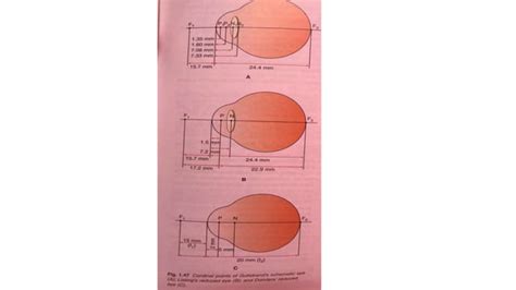 The Schematic Reduced Eye Axes And Angle Of The Eyepptx