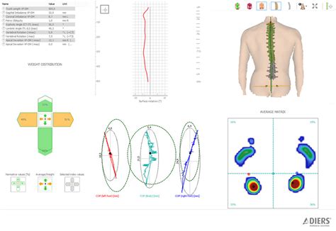 Diers 4d Posture Lab Posture Analysis From Head To Toe