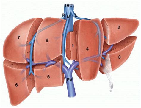 Right Hepatic Trisegmentectomy Basicmedical Key