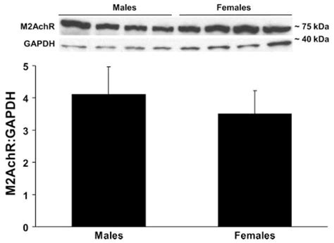 Male Sex Hormones Promote Vagally Mediated Reflex Airway Responsiveness